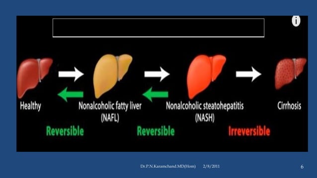 2.What are the Typesof Fatty Liver Diseases? | PPT