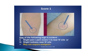 PHLEBITIS NEW INDICATOR FOR NURSES TEACHING SLIDE | PDF