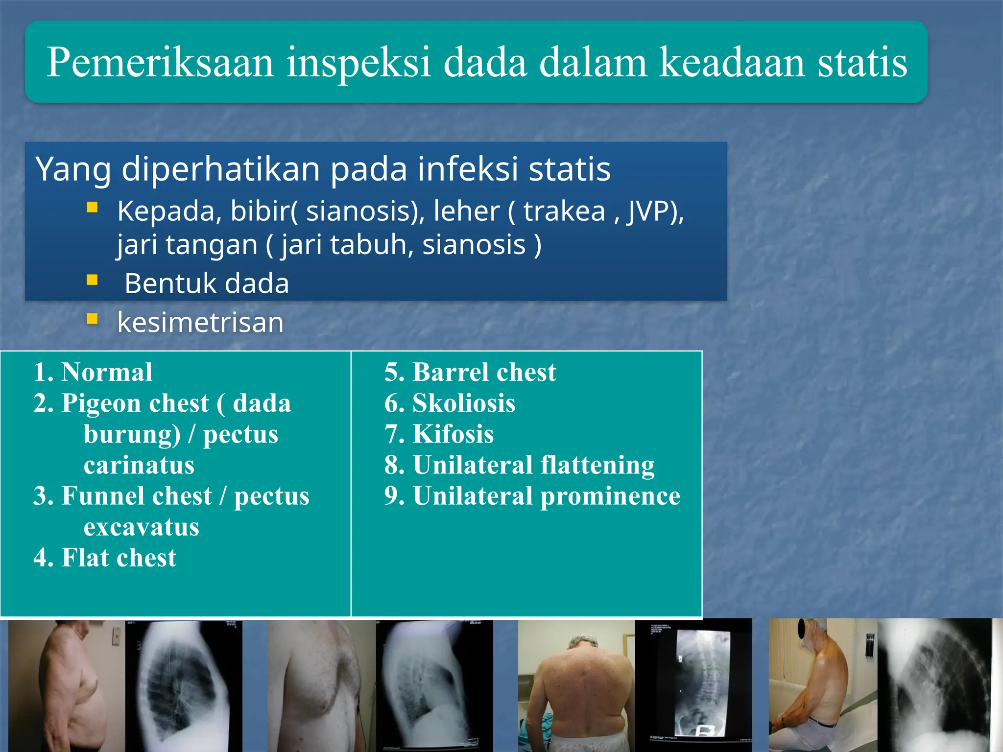 2.6.1.8 Pemeriksaan Fisik Diagnostik Paru.pptx