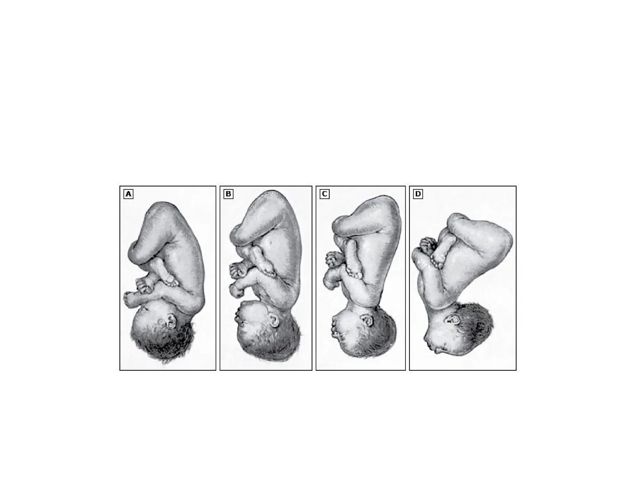 intranatal period during delivery ...... | PPTX