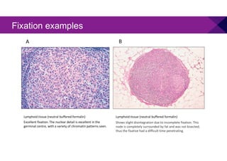 Fixation Histopathologyyyyyyyyyyyyyyyyyyyyyyyyyyyyy | PPT