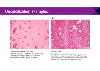 Fixation Histopathologyyyyyyyyyyyyyyyyyyyyyyyyyyyyy | PPT