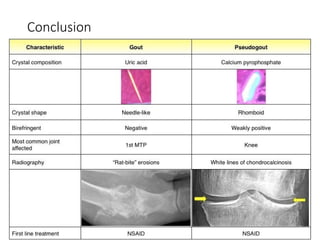 Crystal Arthropathy PowerPoint in rheumatology | PPTX