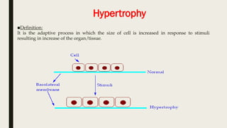 2. General Adaptation, Cell injury and cell death.pptx