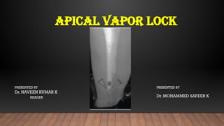 APICAL VAPOUR LOCK in edodontics and dentistry | PPTX