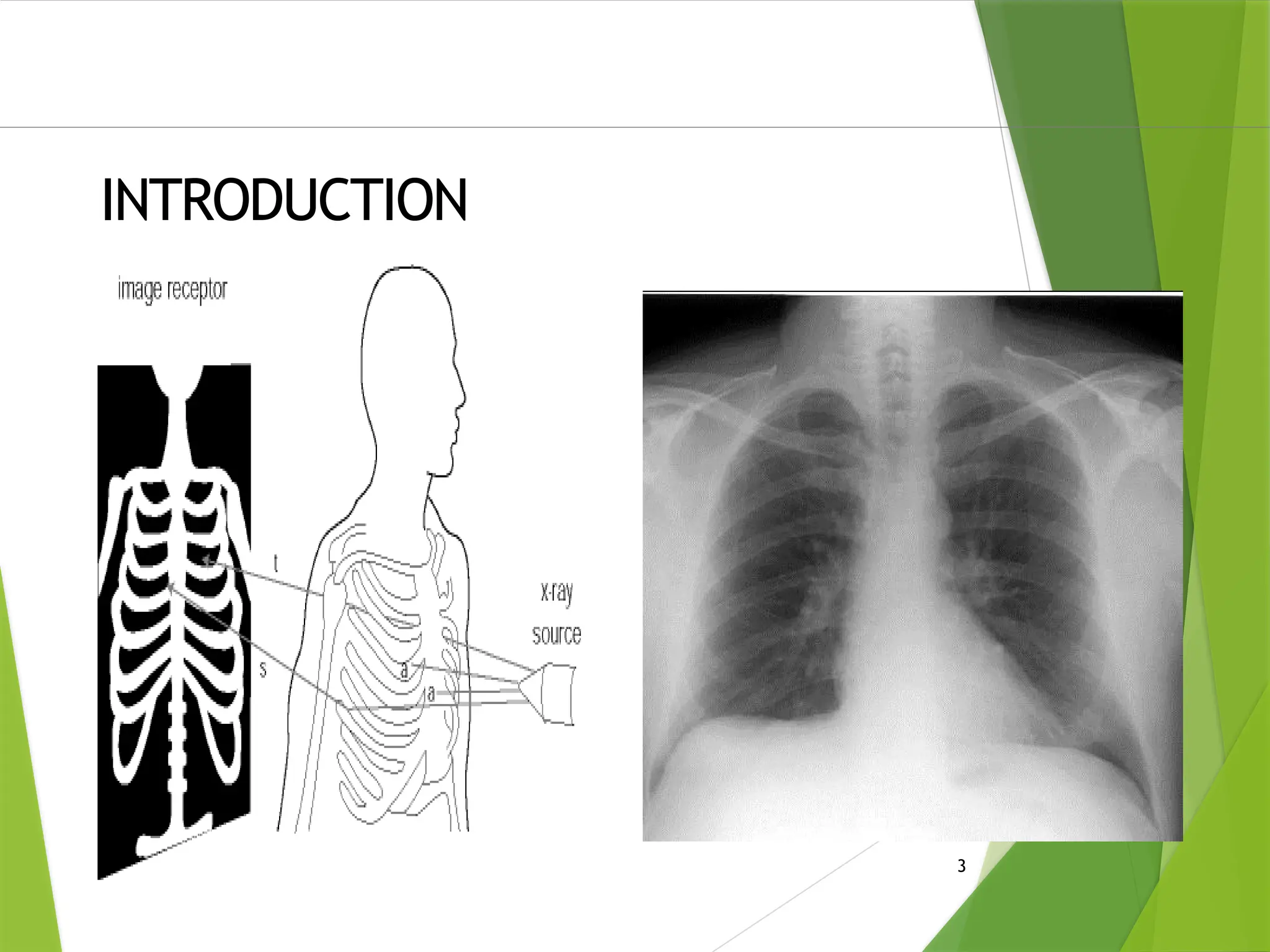 2. RADIOGRAPHIC FILM in Medical Imaging. | PPTX
