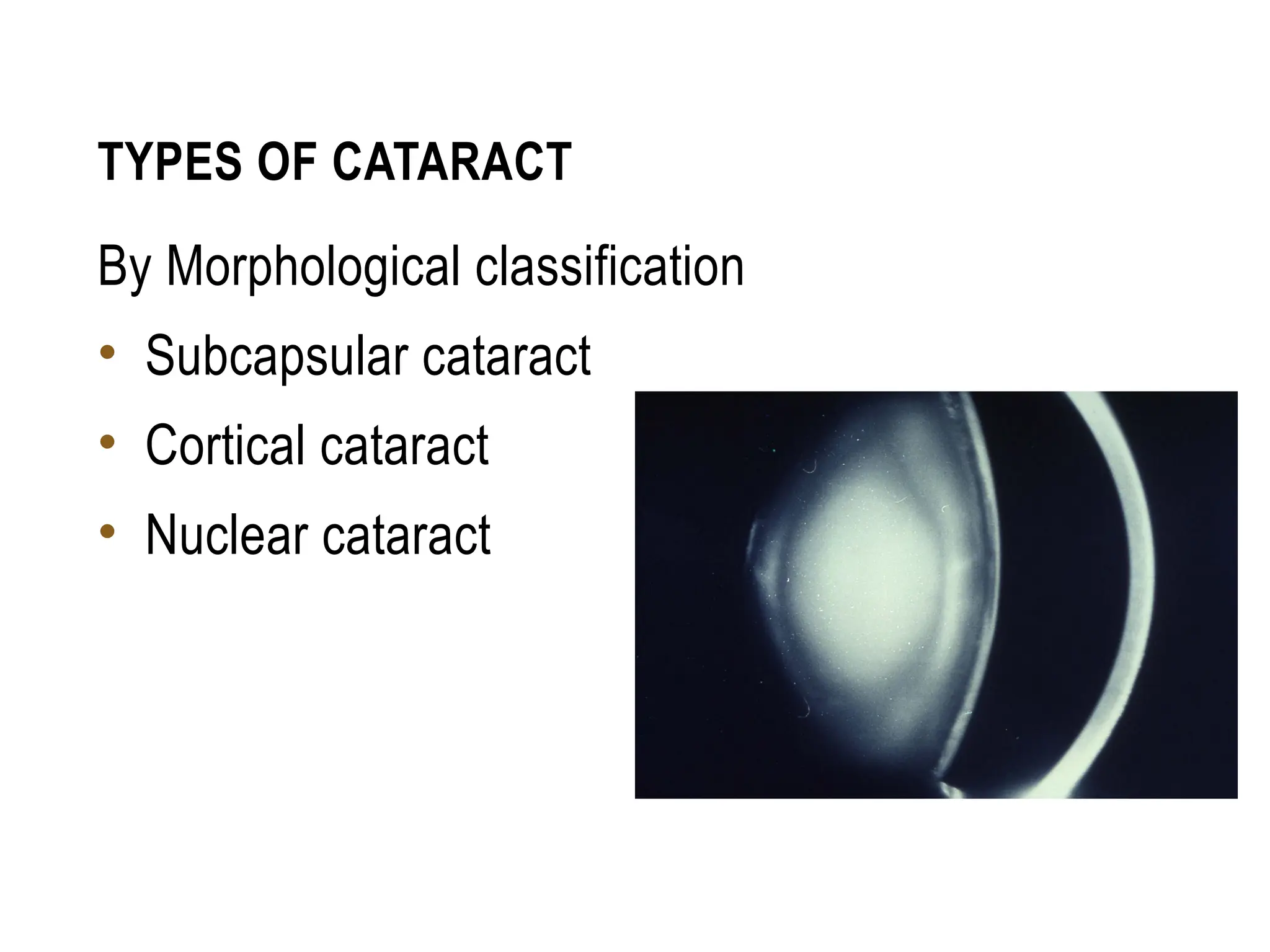 2. Cataract & Aphakia.pptxbzbBBHhHGGGVcVbH | PPTX