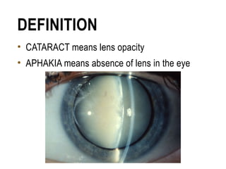 2. Cataract & Aphakia.pptxbzbBBHhHGGGVcVbH | PPTX