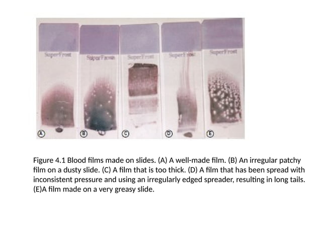 2.BASIC HAEMATOLOGICAL TECHNIQUES (PERIPHERAL BLOOD SMEAR) (2).pptx