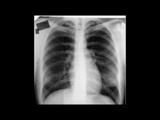 0000000000000000000000000000000000000000000000000 | PPT