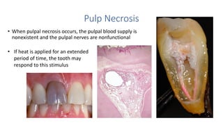 2. pulpitis, DENTAL PULP, PULP CHARACTHERISTICS | PDF