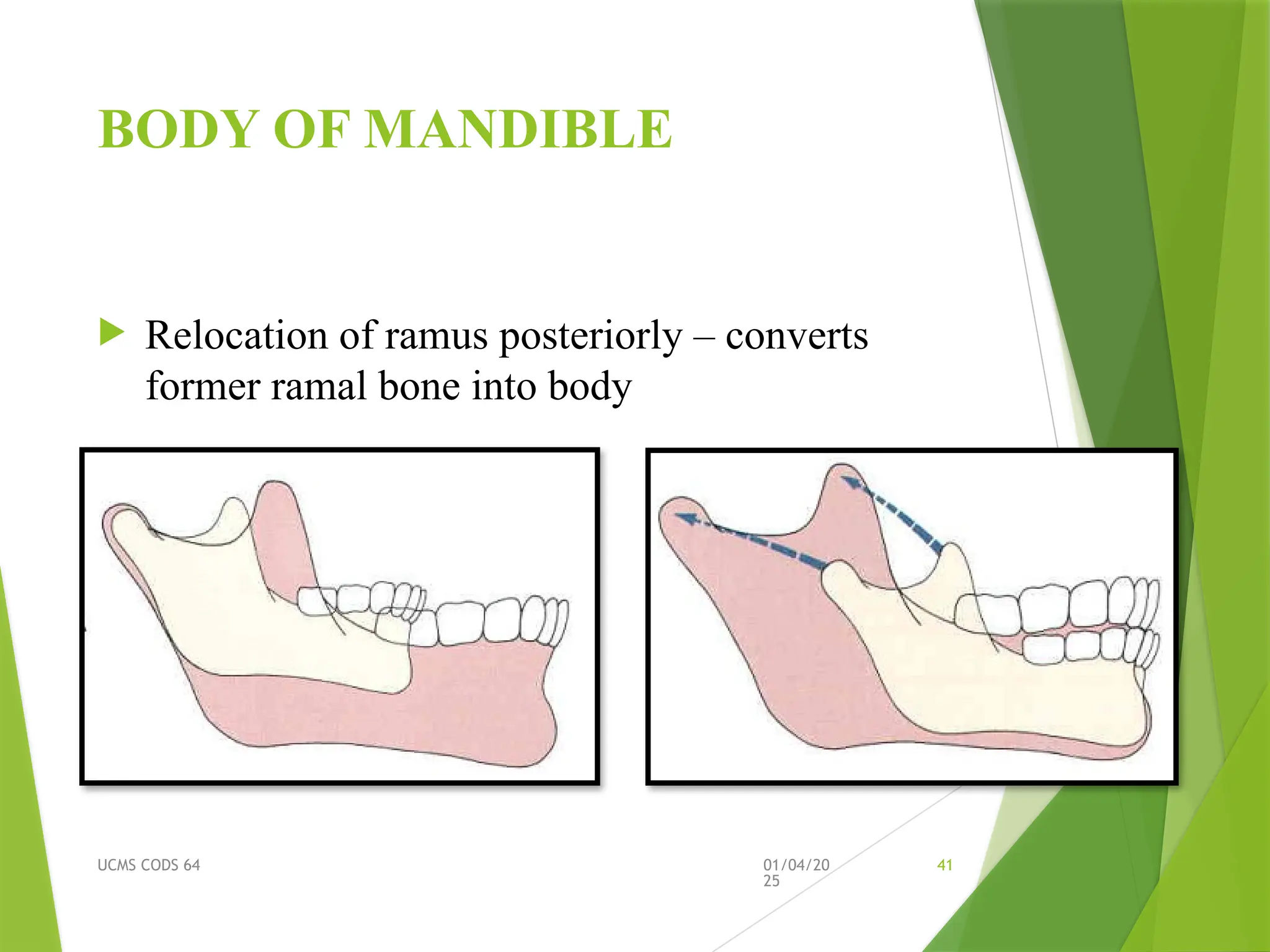 2.postnatal growth of maxila & mandible - Final - Copy.pptx