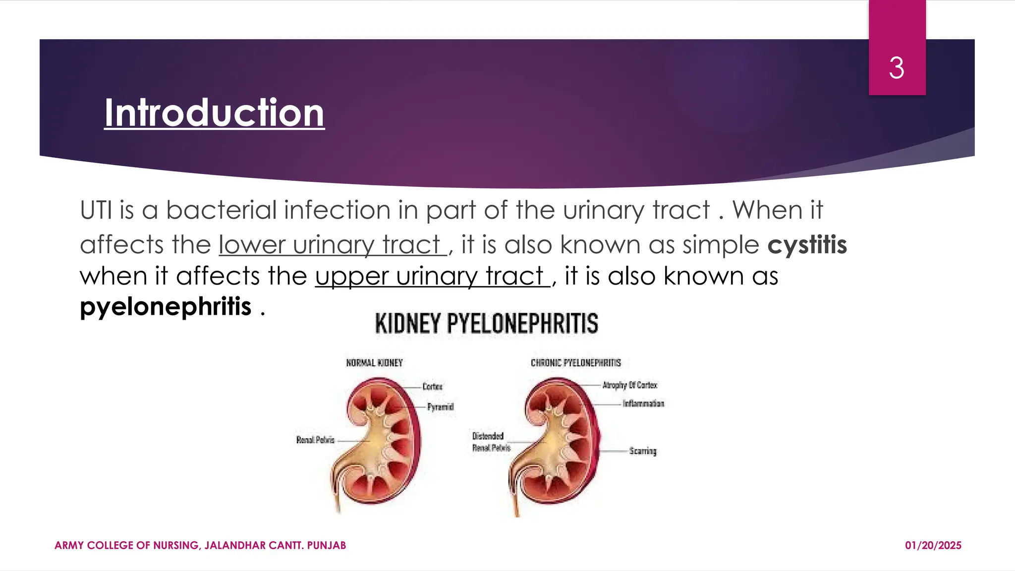 2. PREVENTION OF UTI and nursing management .pptx