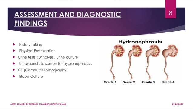 2. PREVENTION OF UTI and nursing management .pptx