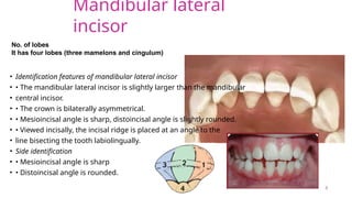 2. Cons main ths-Mand lateral INCISORS - Copy.pptx