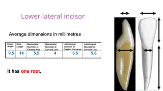 2. Cons main ths-Mand lateral INCISORS - Copy.pptx
