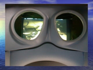 A hernia is the abnormal protrusion of an organ or tissue through a ...