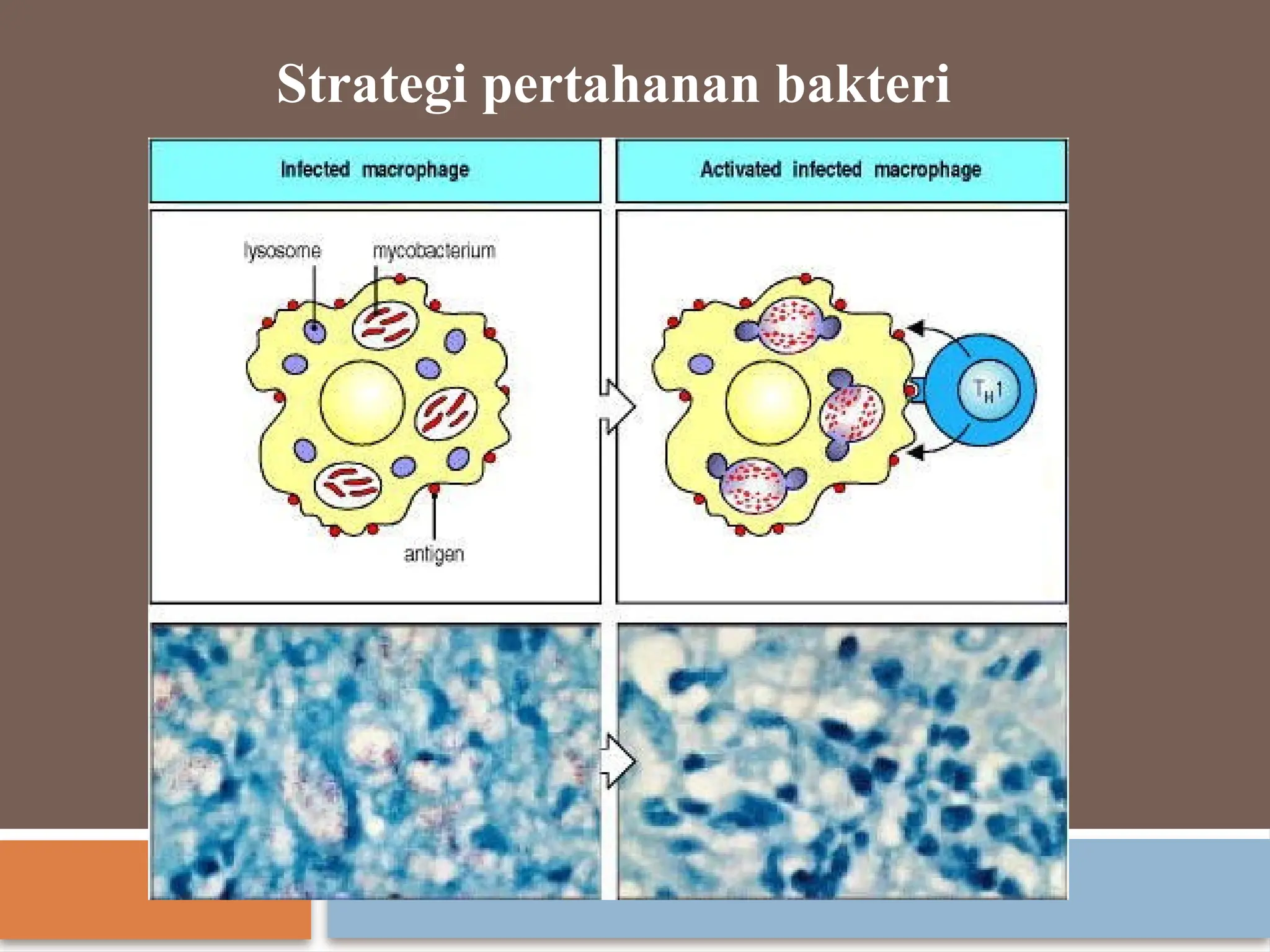 POWERPOINT TENTANG INFEKSI BAKTERI IMUNOSEROLOGI | PPTX