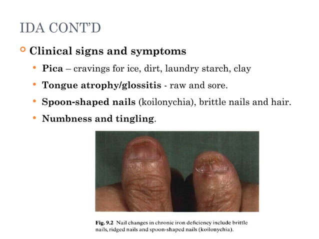 2. Disorder of RBC (Anemia and polycythemia).pptx
