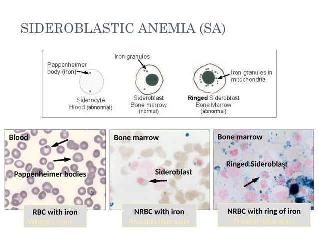 2. Disorder of RBC (Anemia and polycythemia).pptx