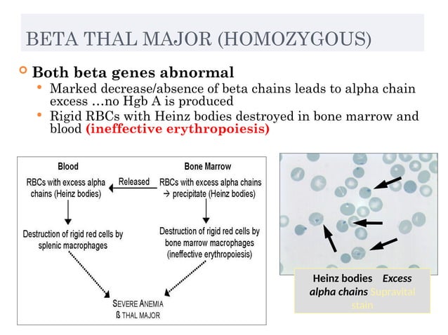 2. Disorder of RBC (Anemia and polycythemia).pptx