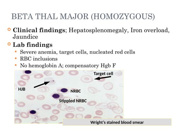 2. Disorder of RBC (Anemia and polycythemia).pptx