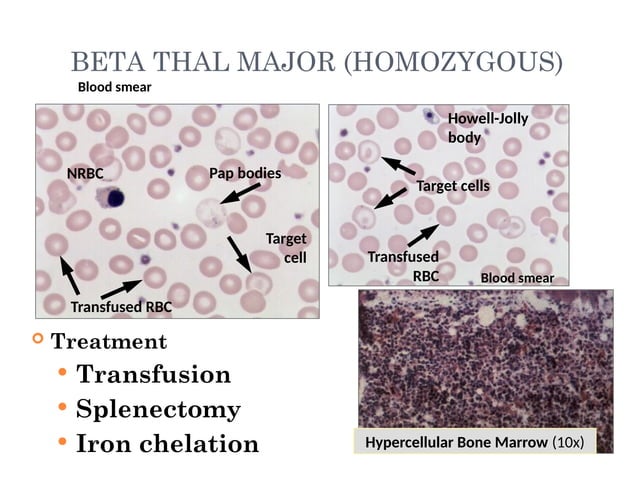2. Disorder of RBC (Anemia and polycythemia).pptx