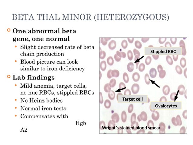 2. Disorder of RBC (Anemia and polycythemia).pptx