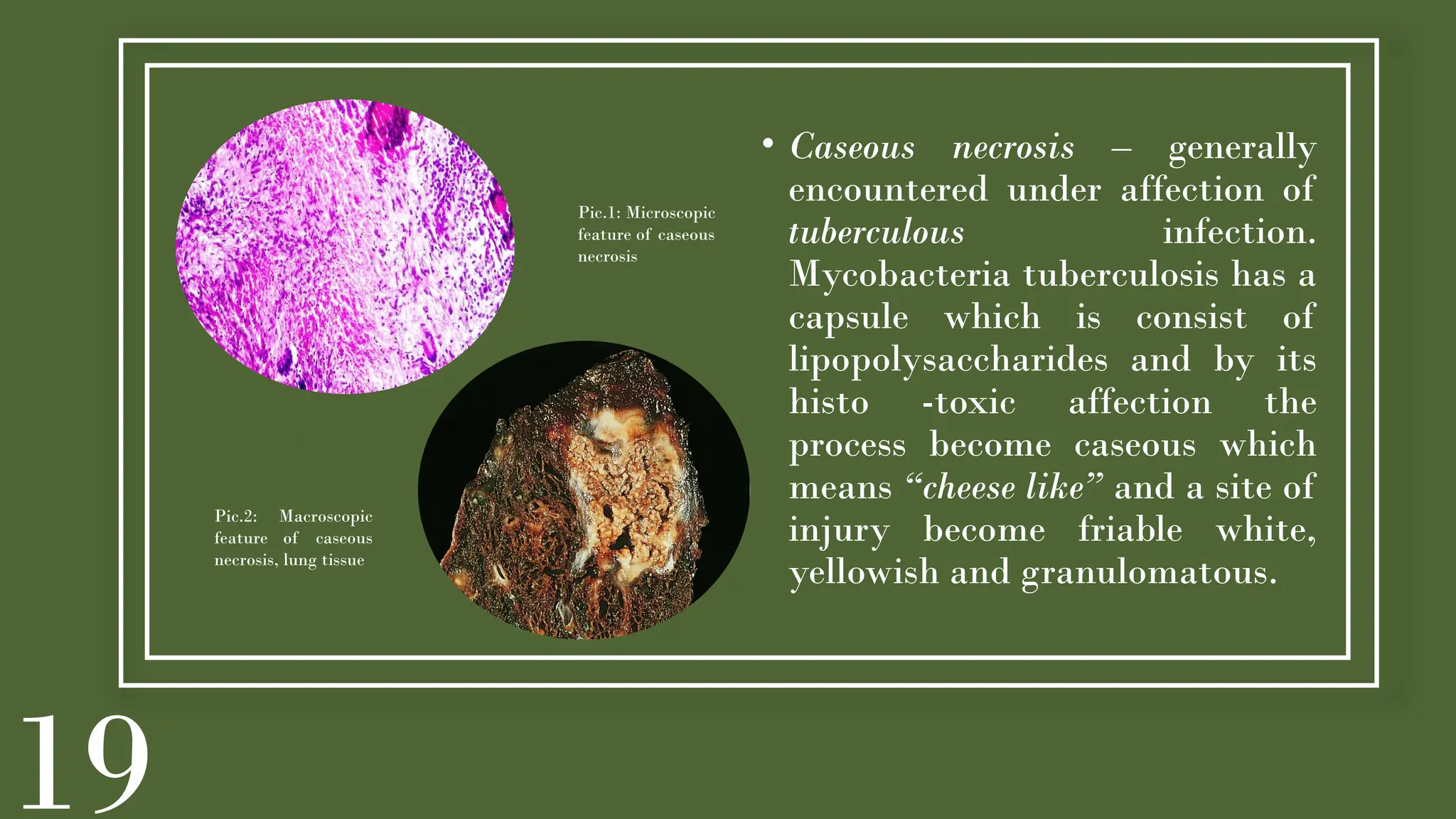 2. Necrosis and apoptosis pathoanatomy.pptx