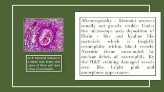 2. Necrosis and apoptosis pathoanatomy.pptx