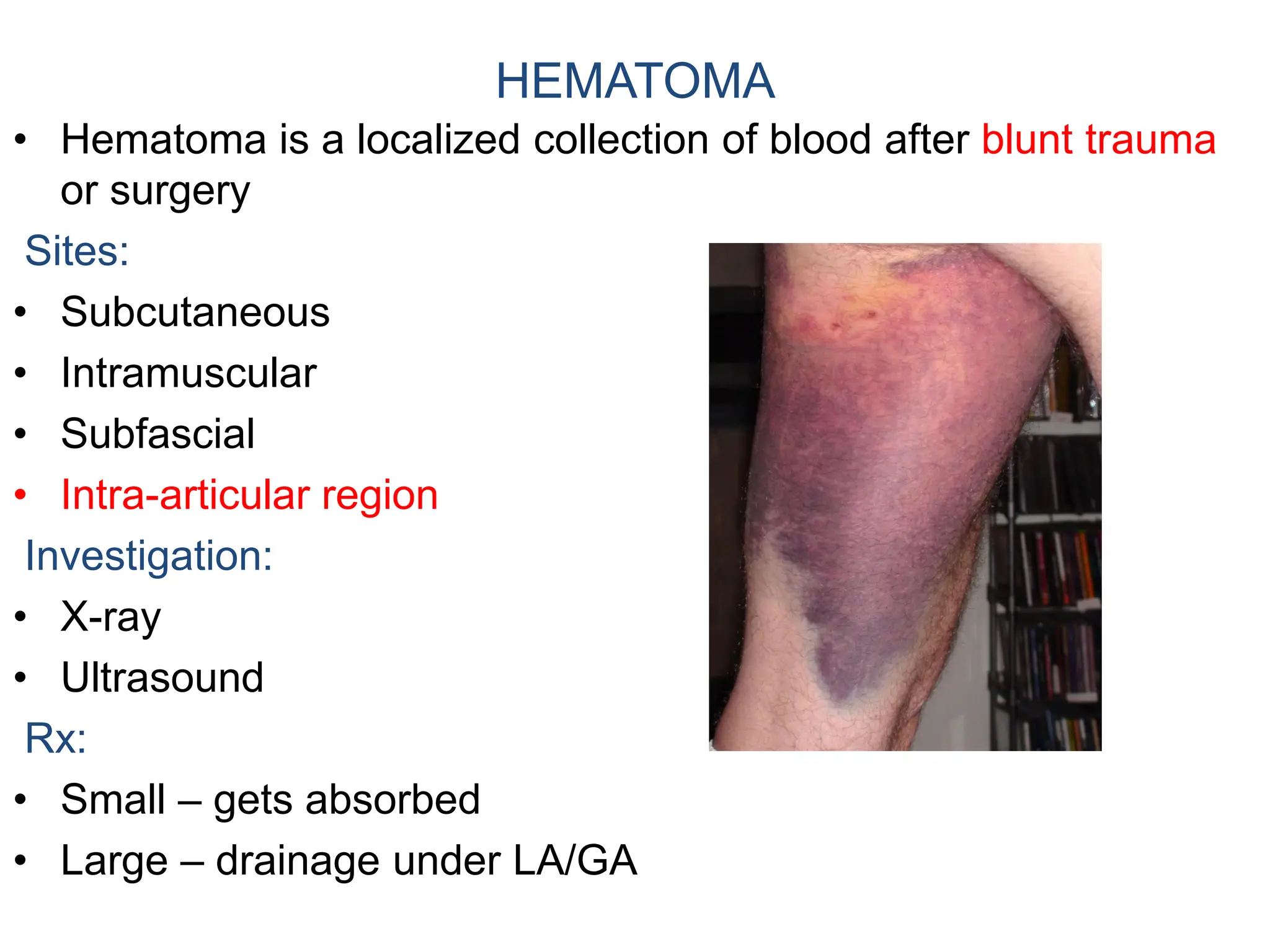 2. soft tissue injuries in Orthopaedics.pdf