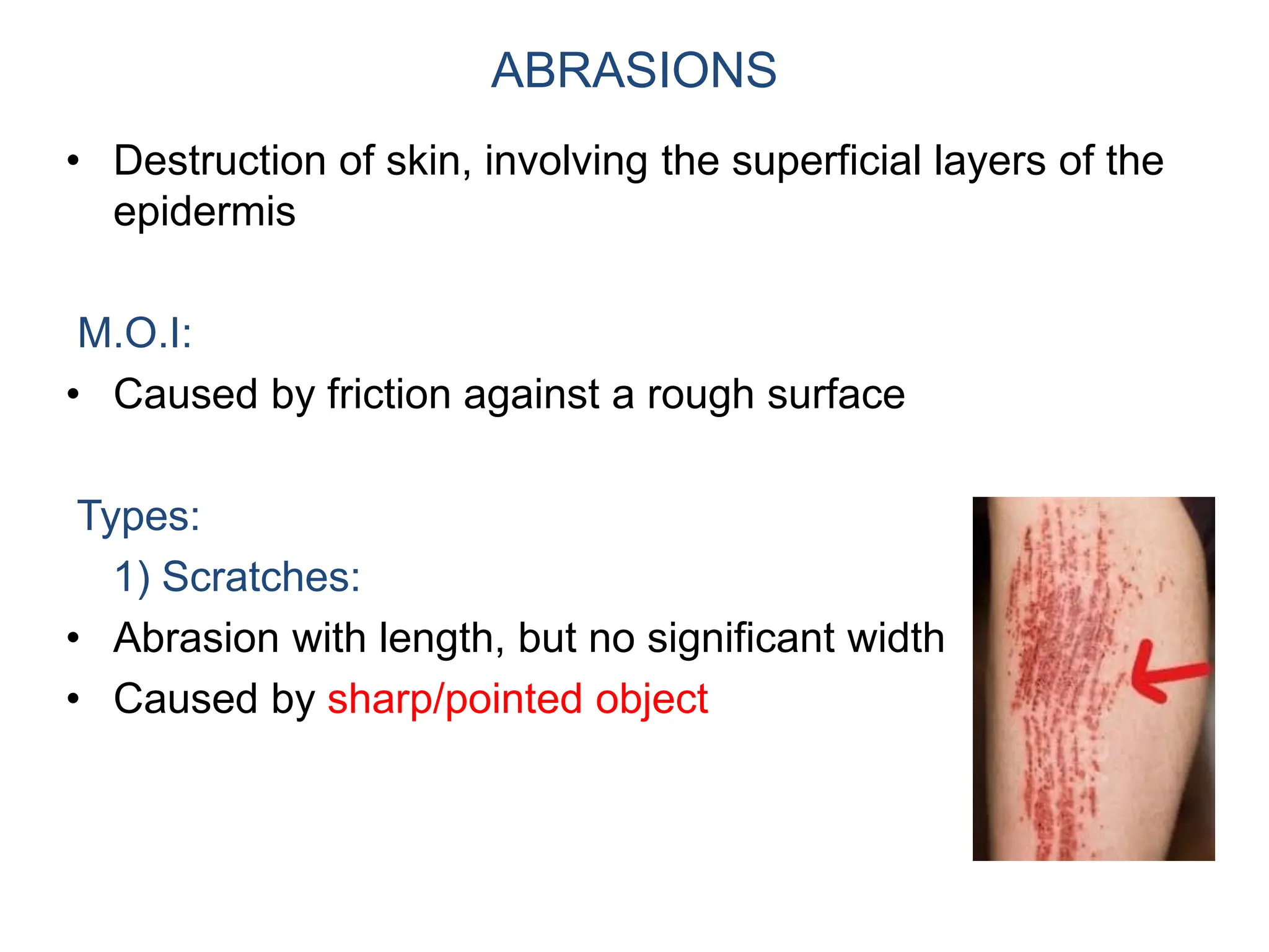 2. soft tissue injuries in Orthopaedics.pdf