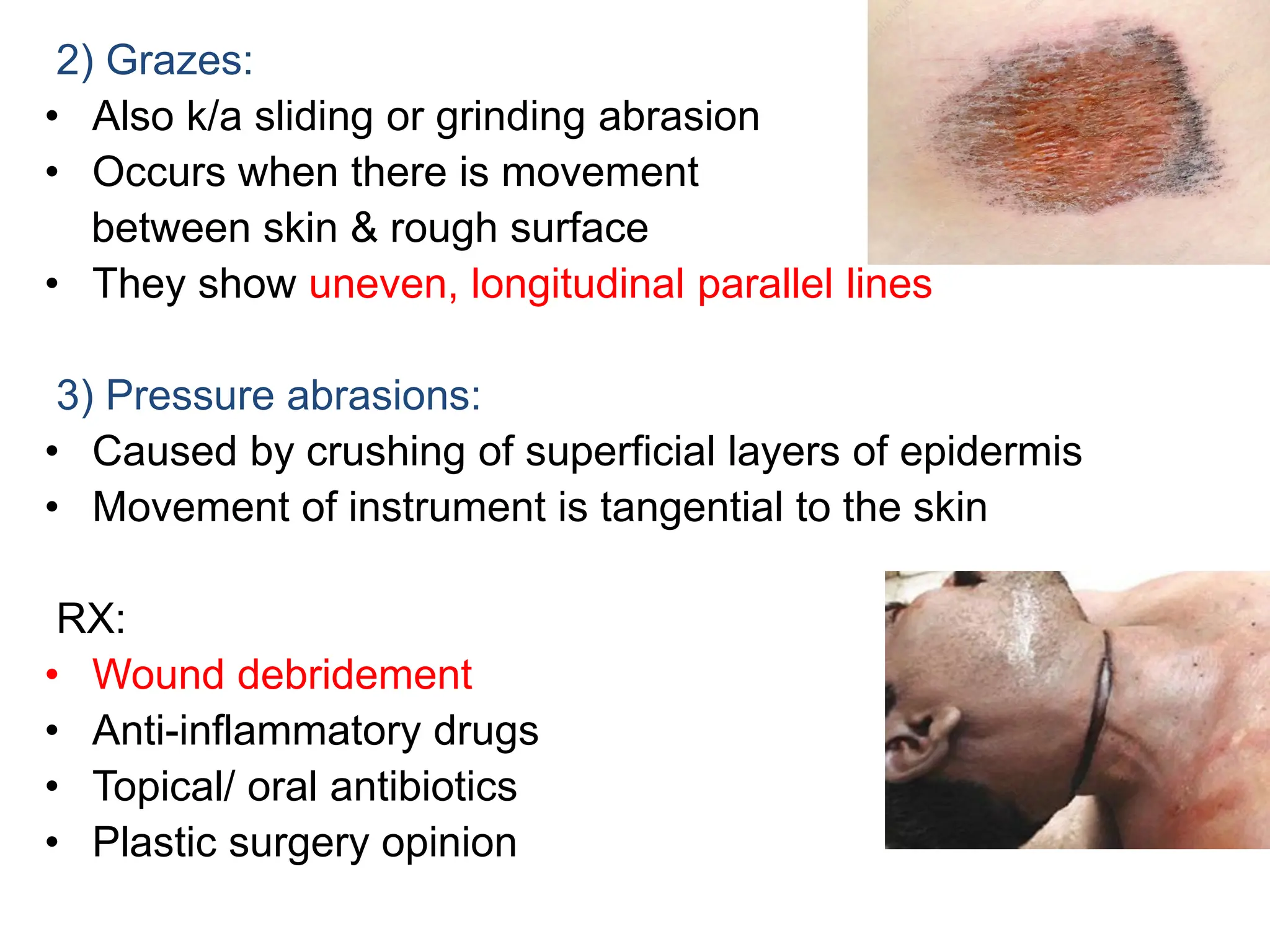 2. soft tissue injuries in Orthopaedics.pdf