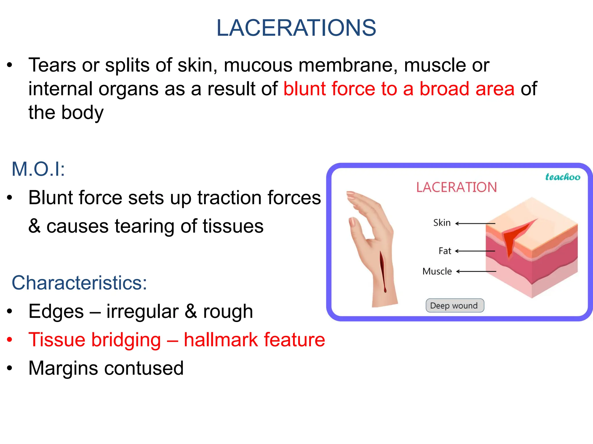 2. soft tissue injuries in Orthopaedics.pdf