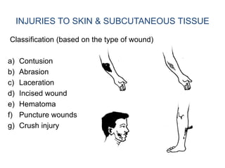 2. soft tissue injuries in Orthopaedics.pdf