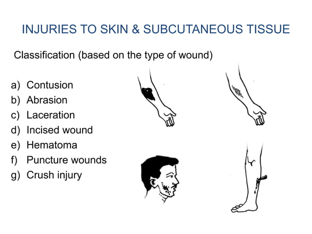 2. soft tissue injuries in Orthopaedics.pdf