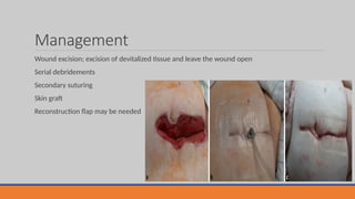 2. wound , dressing and badges a topic of general surgery.pptx