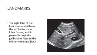 2.1 USG abdomen -LIVER anatomy and scanning techniques.ppt by ajit | PPTX