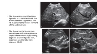 2.1 USG abdomen -LIVER anatomy and scanning techniques.ppt by ajit | PPTX