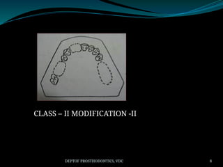 2. kennedysclassificationC ii.pptx
