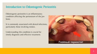 2.Odontogenic Periostitis Of Jaw Bone.pdf