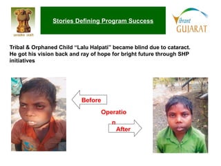 Introduction of rbsk program and school health | PPTX