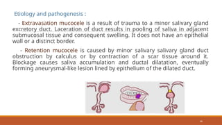 salivary gland salivary gland salivary gland salivary gland | PPTX