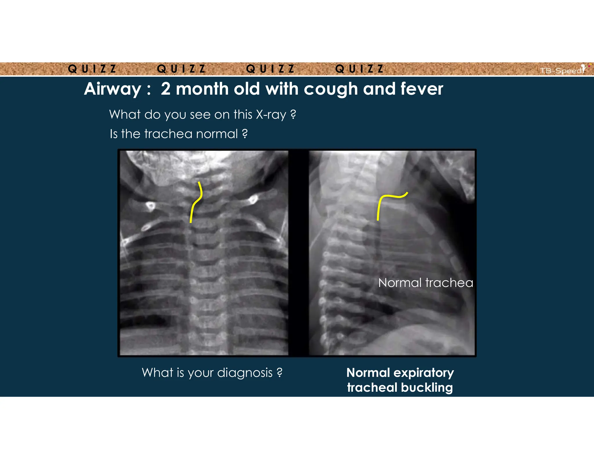 2.8 Airway.............................pdf