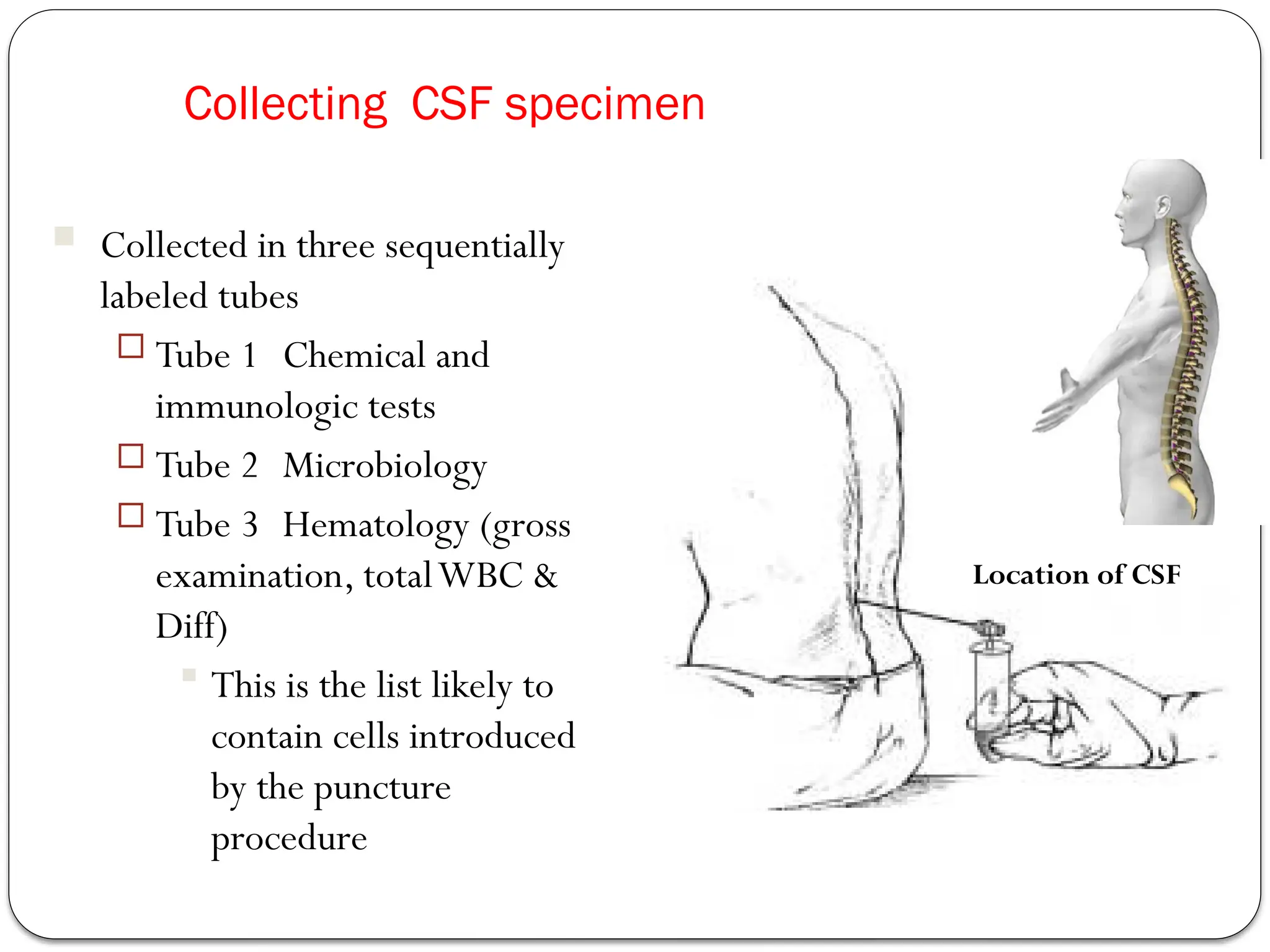2.8 CSF ZY 2024.pptx000000000000000000000000000 | PPTX