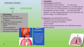 Síndromes pleurales de neumotórax y derrame pleural.pptx