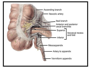 2. Acute appendicitis is the inflammation of vermiform appendix | PPTX