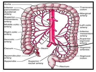 2. Acute appendicitis is the inflammation of vermiform appendix | PPTX