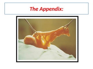 2. Acute appendicitis is the inflammation of vermiform appendix | PPTX