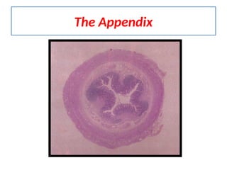 2. Acute appendicitis is the inflammation of vermiform appendix | PPTX